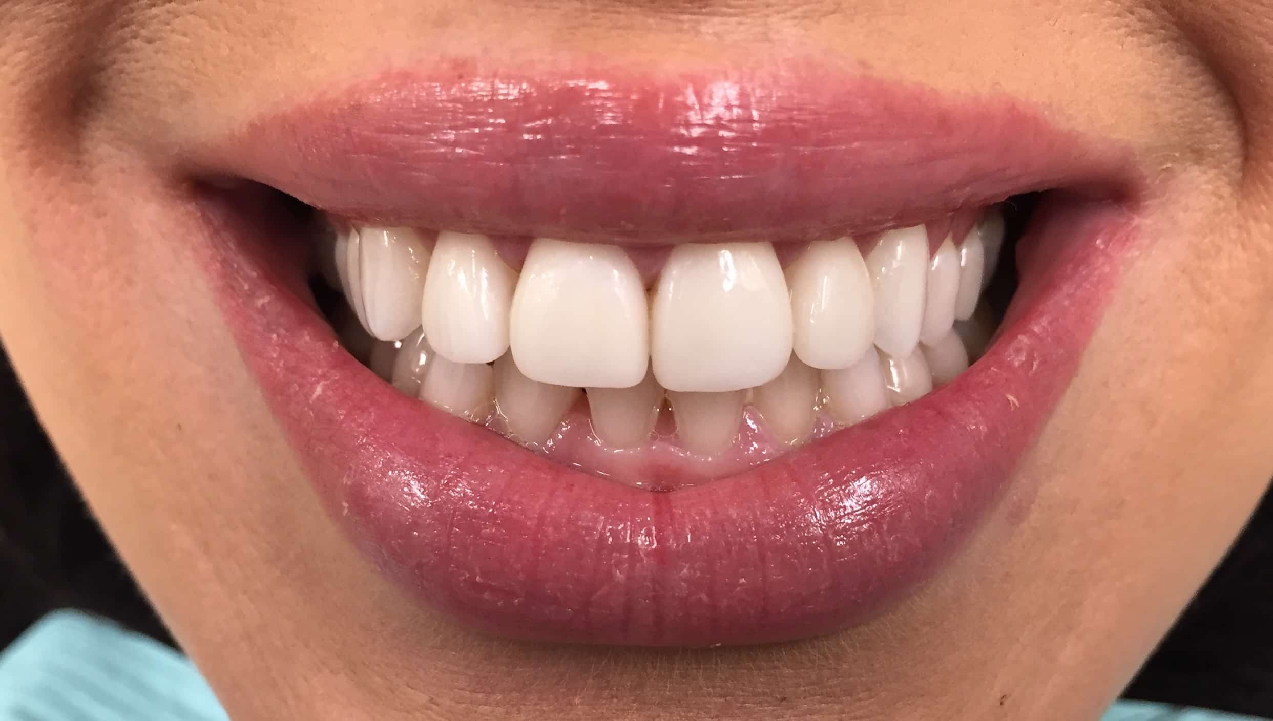 Gallery Commack Dental